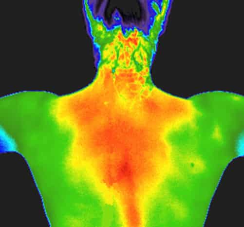 Termografia Médica: Saiba Tudo - Agende sua Avaliação